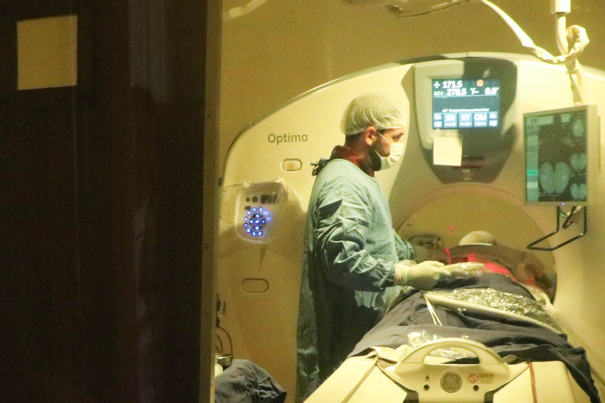 HSVP realiza pioneiro procedimento de crioablação para tratar tumor ...